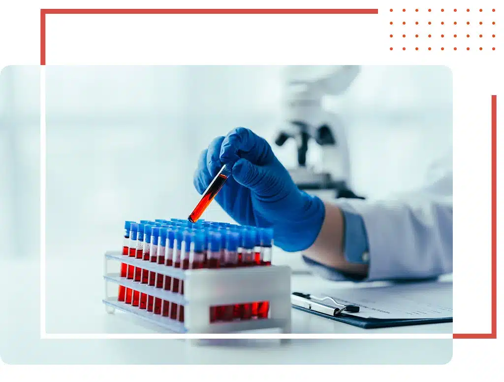 Lab Test Services in Katy, TX | Walk-in Lab Services Katy
